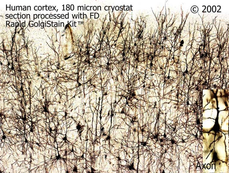 Rapid Golgi Stain Kit for Fast Neuronal Analysis - FD Neuro ...