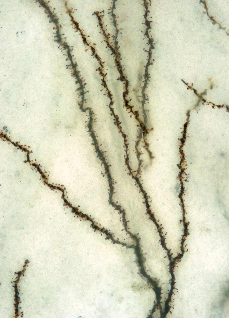 Rapid Golgi Stain Kit for Fast Neuronal Analysis - FD Neuro ...