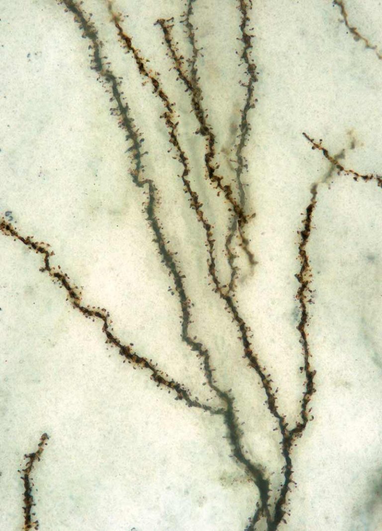 Rapid Golgi Stain Kit for Fast Neuronal Analysis - FD Neuro ...