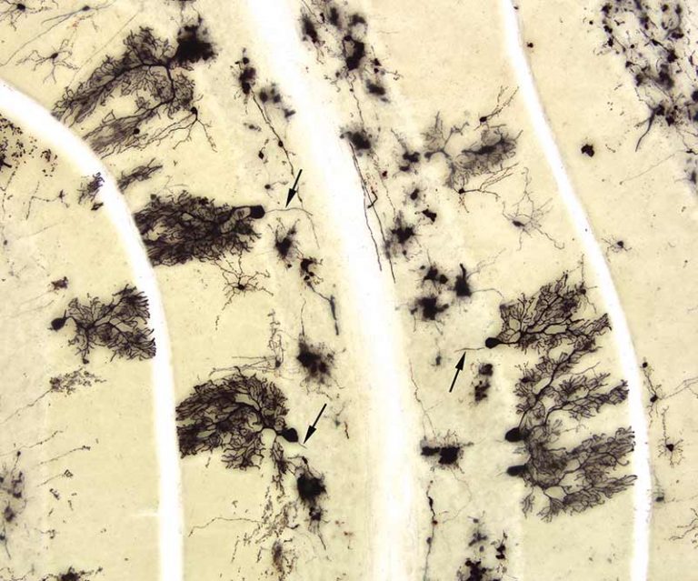 Rapid Golgi Stain Kit for Fast Neuronal Analysis - FD Neuro Technologies, Inc.