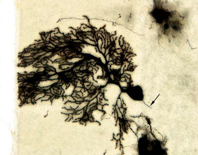 Rapid Golgi Stain Kit for Fast Neuronal Analysis - FD Neuro Technologies, Inc.