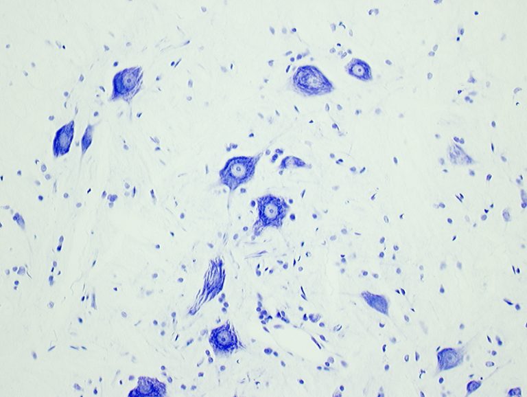 FD Thionin Solution™ (Double Strength) - FD Neuro Technologies, Inc.