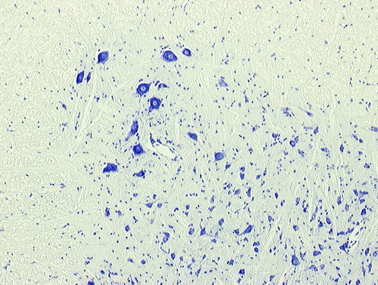 Thionin Stain for Nerve Tissue Visualization Use - FD Neuro ...