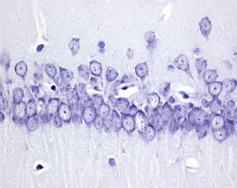 Cresyl Violet Solution for Nerve Tissue Staining - FD Neuro ...
