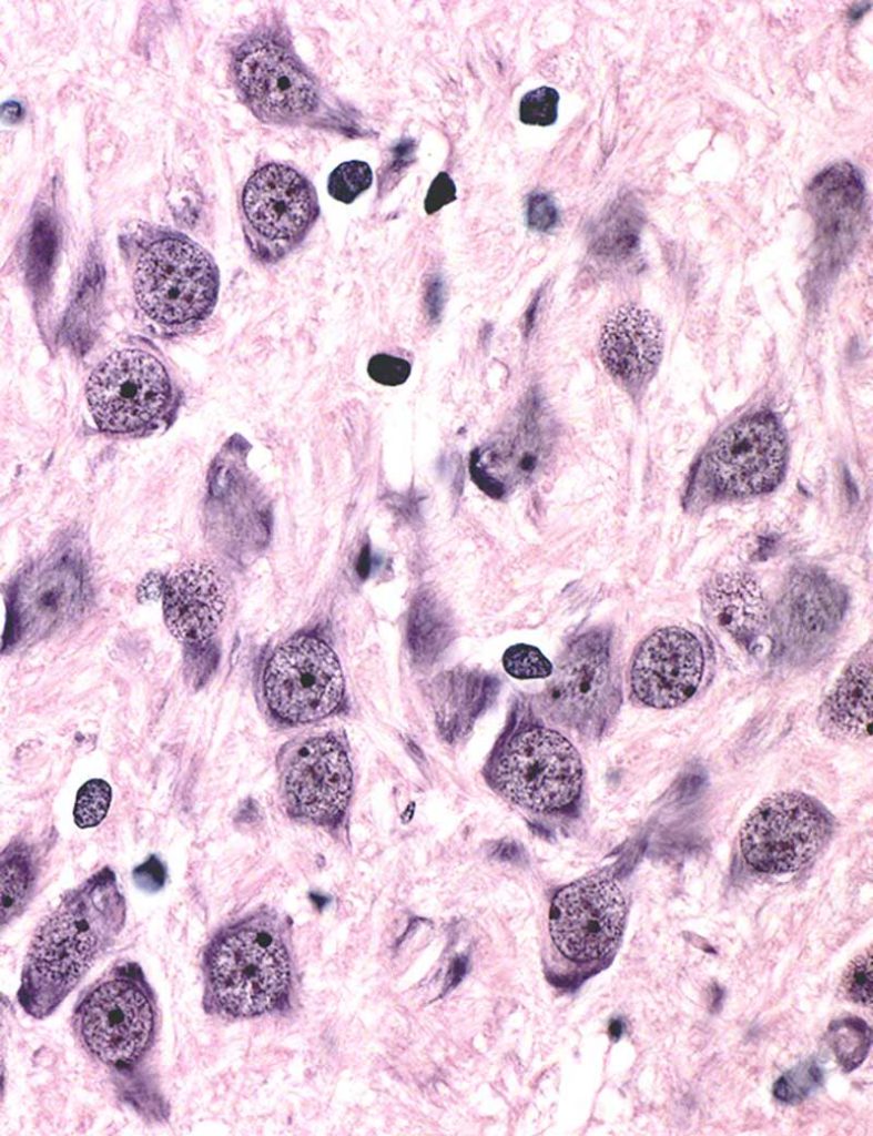 Hematoxylin Solution for Reliable Laboratory Results - FD Neuro ...
